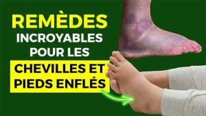 10 remèdes incroyables pour les chevilles et les pieds enflés - Santé ...