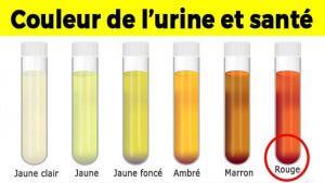 Ce que la couleur de votre urine dit de votre santé - Santé Nutrition
